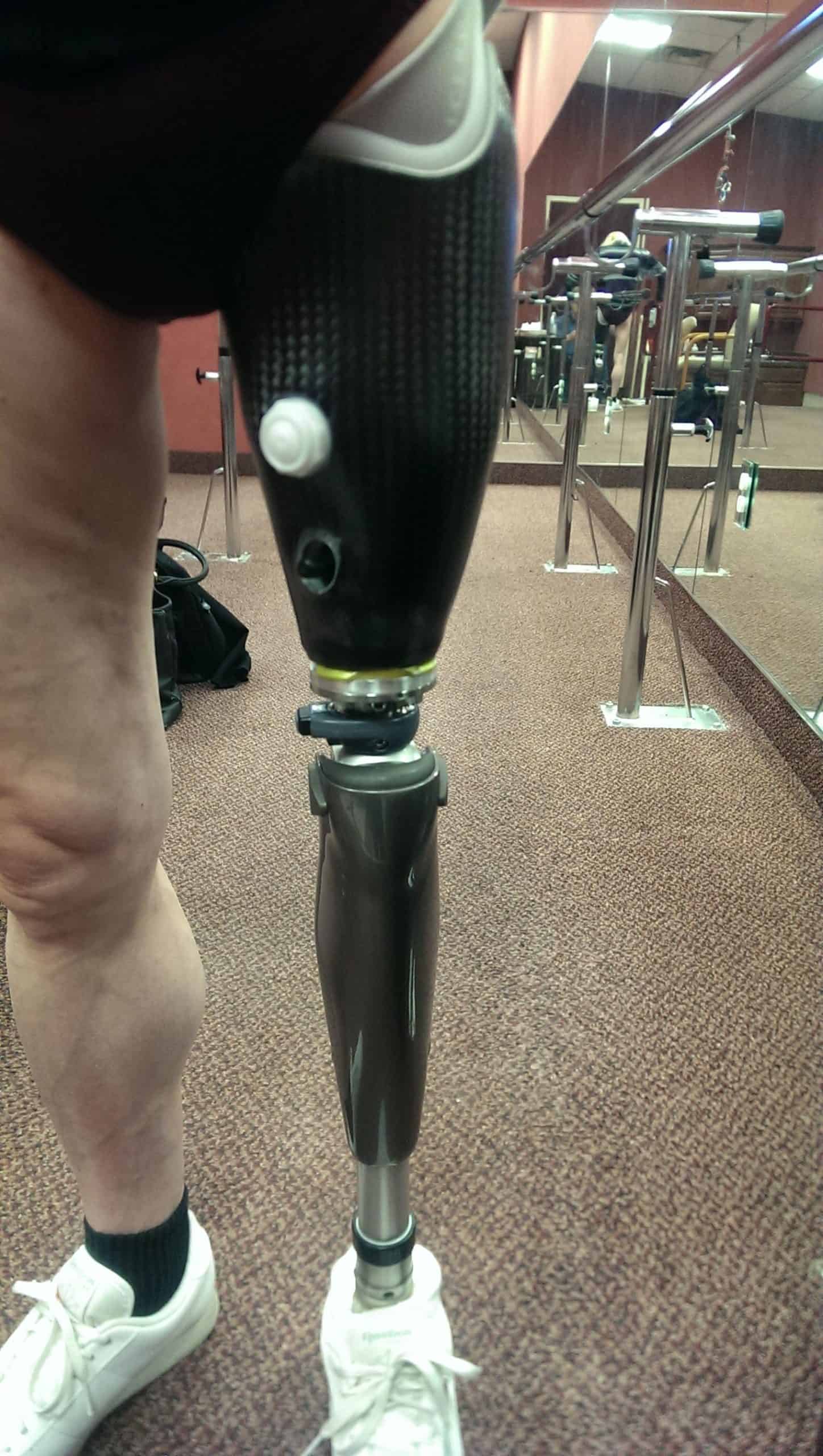 Testimonials | Patients Care | Perry Prosthetics