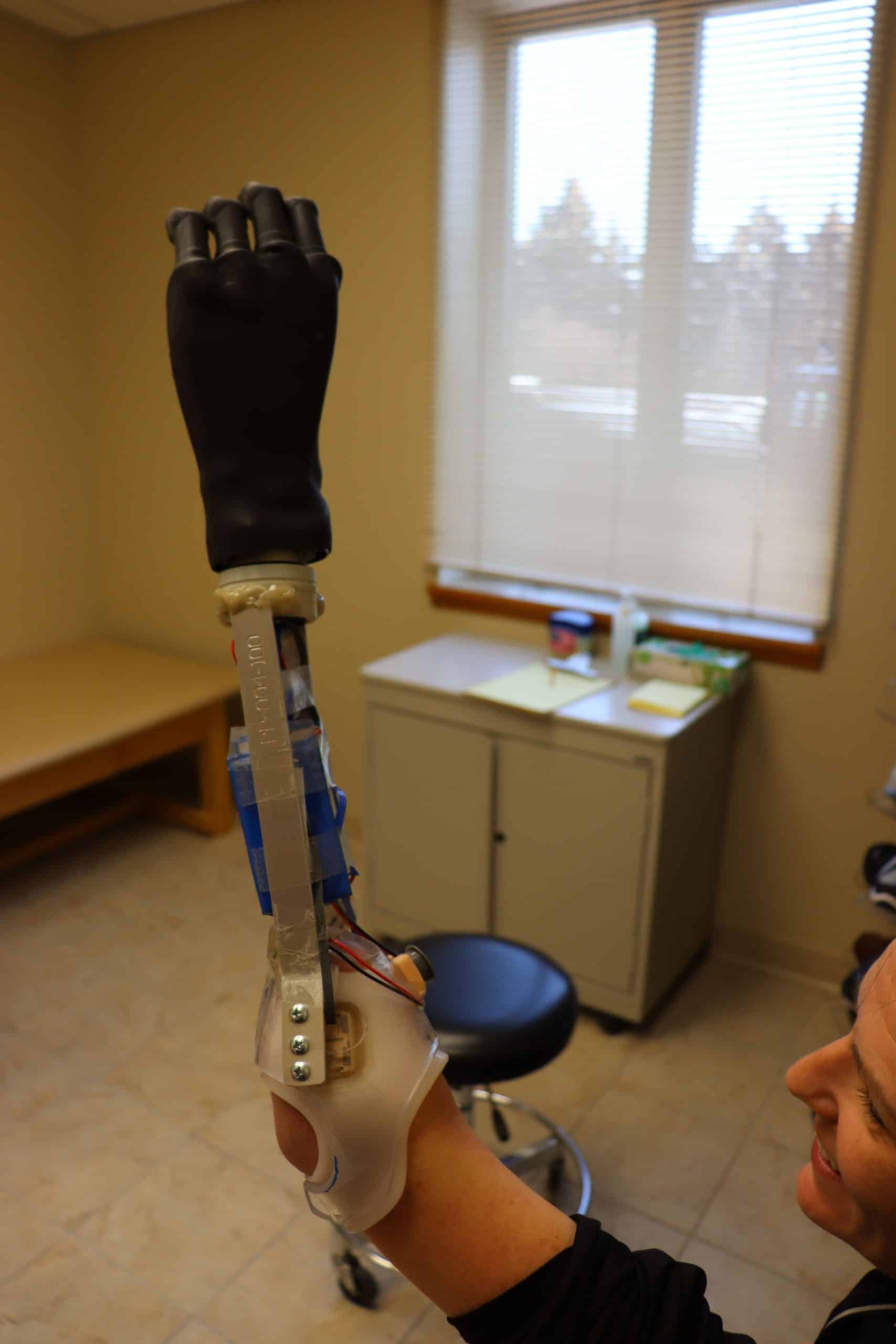 Testimonials | Patients Care | Perry Prosthetics